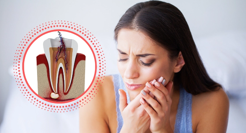 How to Manage Pain During a Root Canal | Dearborn Dentist – Hashwi Dental